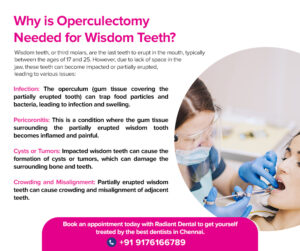 What is Operculectomy Surgery Related To Wisdom Teeth