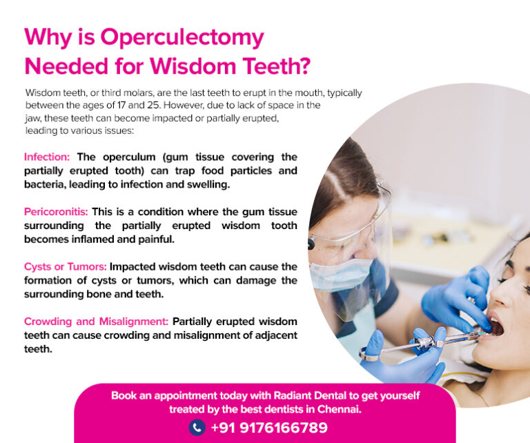 What is Operculectomy Surgery Related To Wisdom Teeth