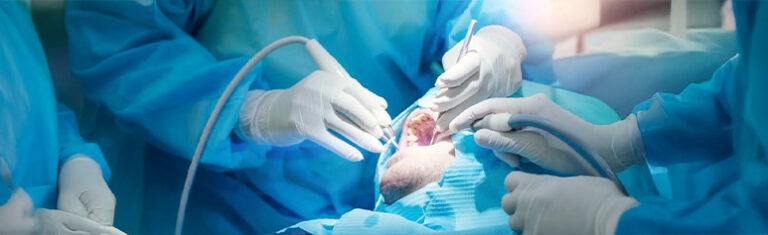 Wisdom Tooth Surgery: Procedure, Recovery, Costs