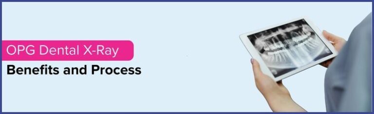 OPG Dental X-Ray Benefits and Process| Radiant Dental Care