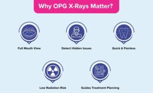 OPG Dental X-Ray Benefits and Process| Radiant Dental Care