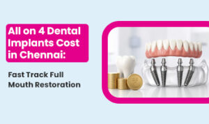 All on 4 Dental Implants Cost in Chennai: Fast Track Full Mouth ...